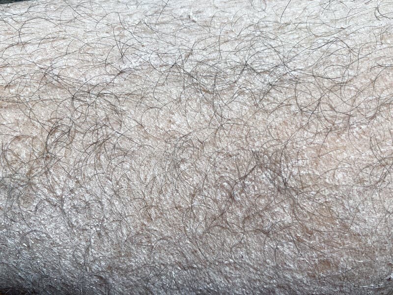 Powder on body skin stock image. Image of wound, texture - 251212649