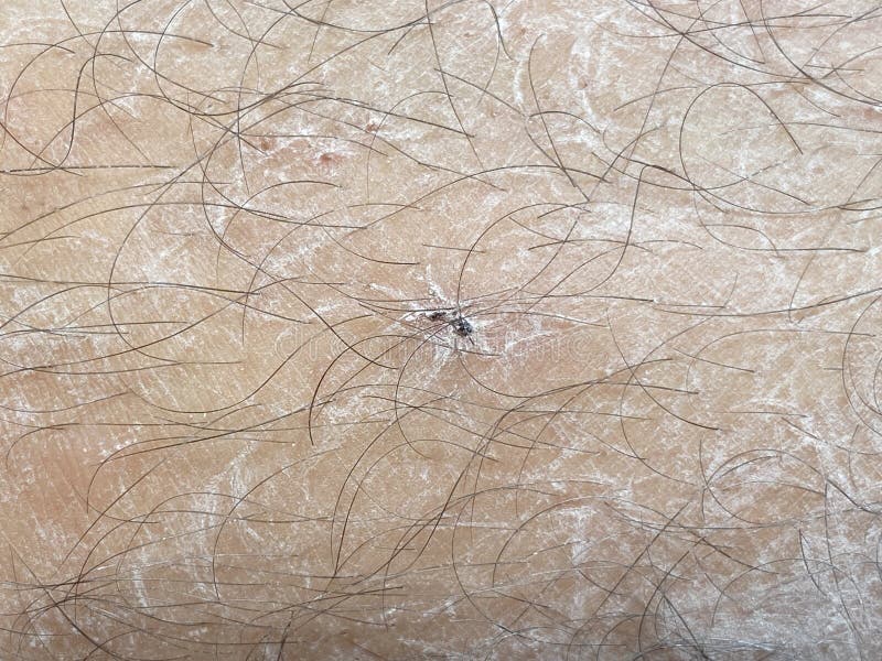 Powder on body skin stock image. Image of beautiful - 251211835