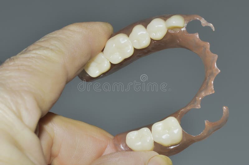 Prótese flexível 8 imagem de stock. Imagem de resina - 36473729