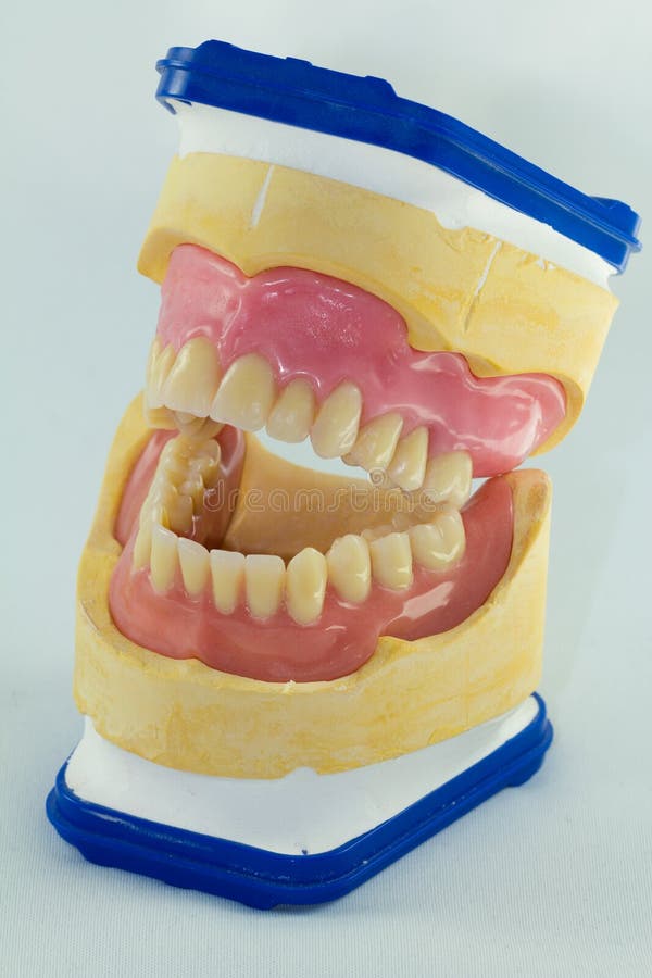 Prótesis Total Dental De La Cera Imagen de archivo - Imagen de médico ...