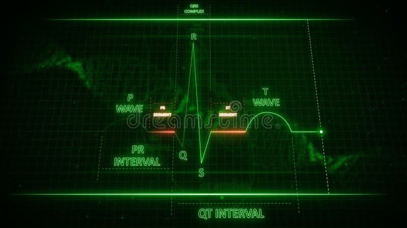 ST Segment from Electrocardiogram Wave or ECG or EKG Stock Illustration ...