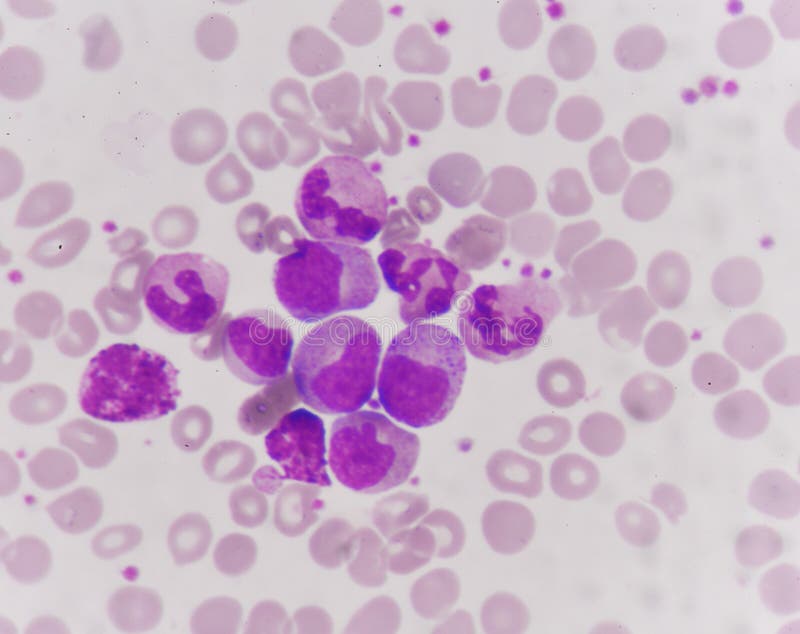 A Precursor Cell, Also Called a Blast Cell or Simply Blast, is a Stock ...