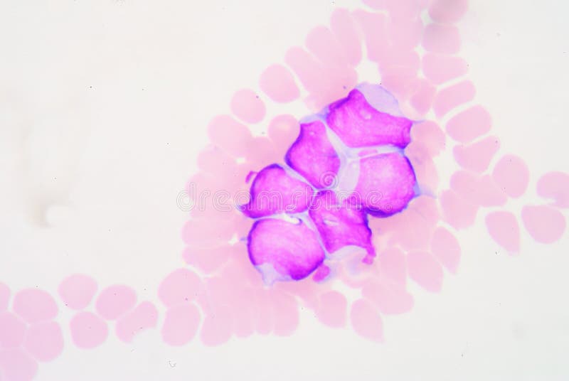 A Precursor Cell, Also Called a Blast Cell or Simply Blast, is a Stock ...