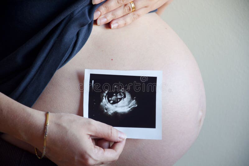 Pregnacy stock image. Image of ultrasound, baby, birth - 48656157