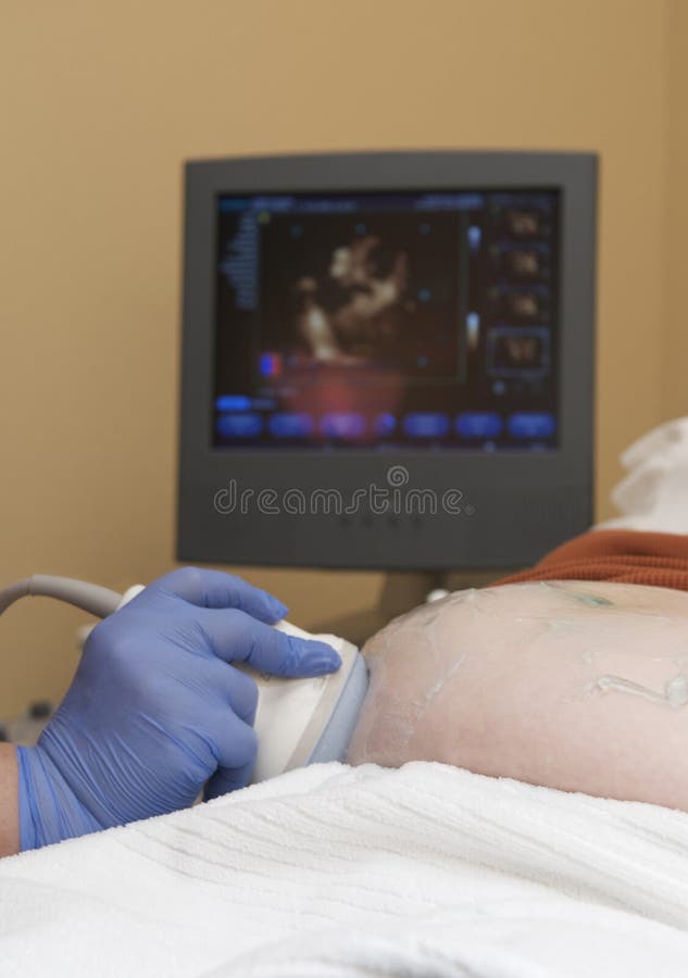 Sonogram stock image. Image of mother, health, baby, girl - 24477