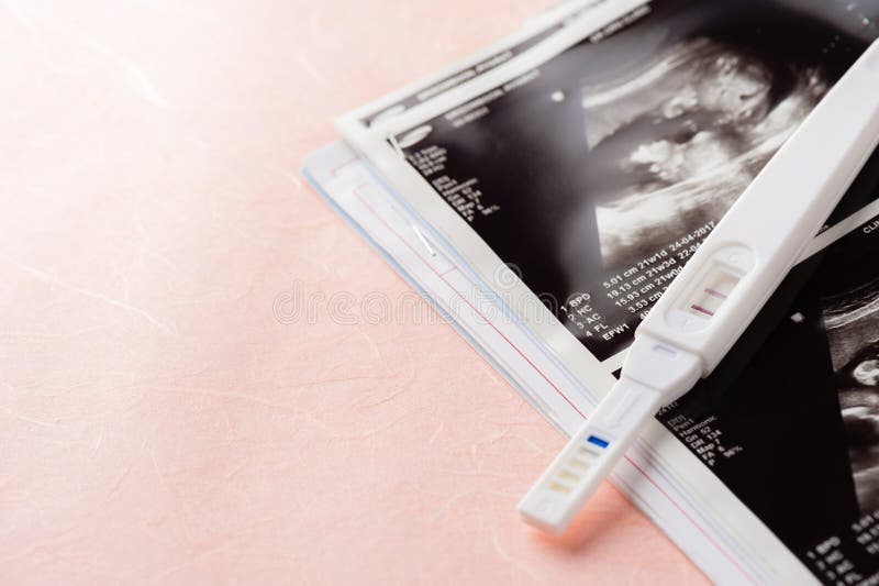 The pregnancy test stock image. Image of gynecological - 342891153