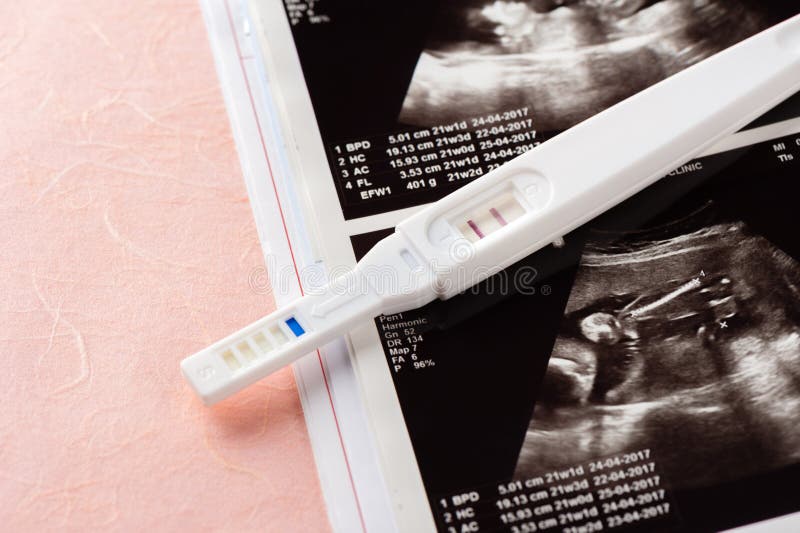 The pregnancy test stock photo. Image of medical, women - 342891156