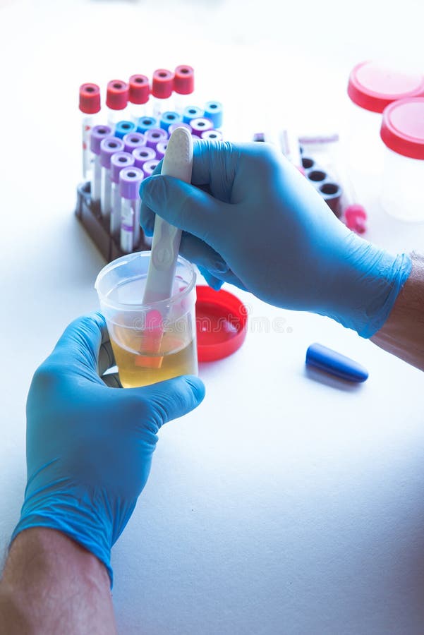 Pregnancy test, HCG. stock image. Image of research - 111552413