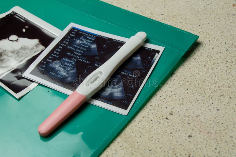Pregnancy Test Object Two Red Lines with Green Folder Book Background ...