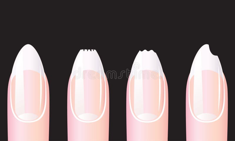 Tipos Diferentes De Formas Do Prego Tipos De Arcos Do Prego Ciência Do ...