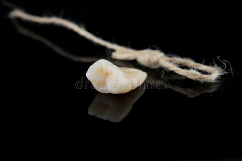 Human Tooth after Extraction with Roots Tied with a Thread on a Black ...