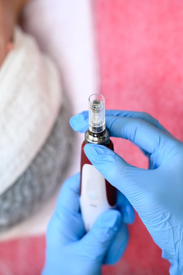 Preparation of Dermapen for the Rejuvenation Procedure. Stock Image ...