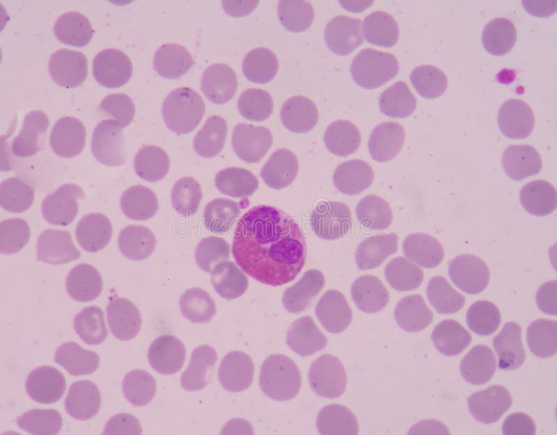 Eosinophil granulocytes stock image. Image of medical - 59469623