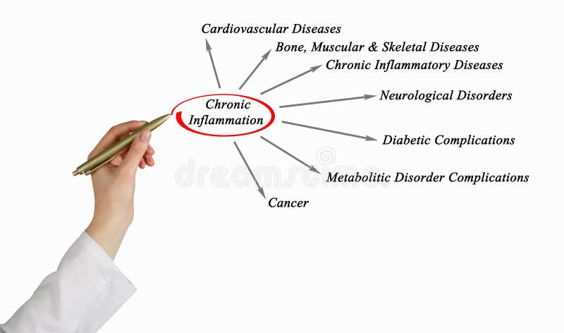 Chronic Inflammation stock image. Image of metabolitic - 85673379