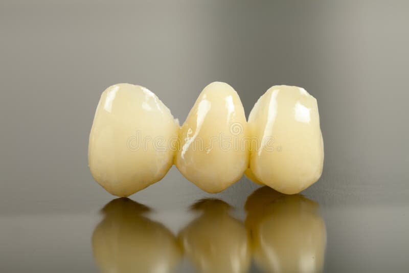 Pressed ceramic crown stock image. Image of prosthesis - 29249375