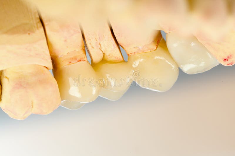 Pressed ceramic teeth stock image. Image of products - 29285319