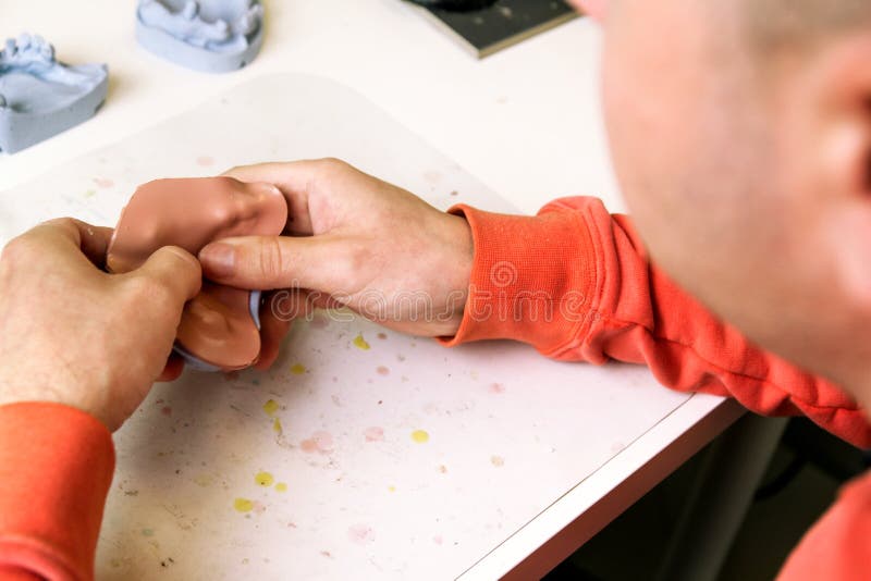 Pressing of Shellac Base Plates Over the Plaster Model Stock Photo ...