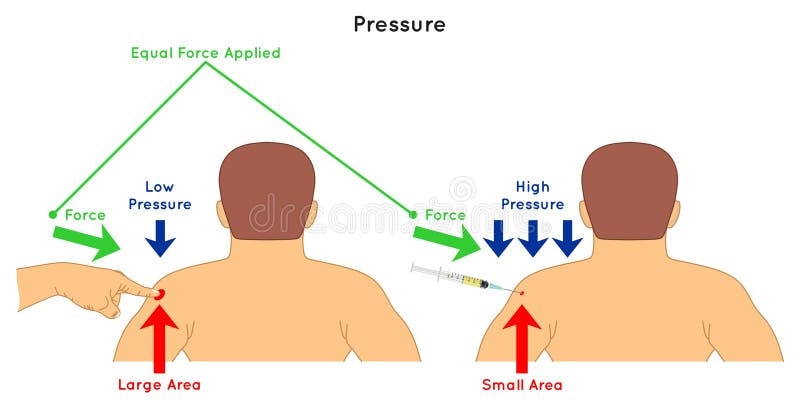 Pressure Infographic Diagram with Example Stock Vector - Illustration ...