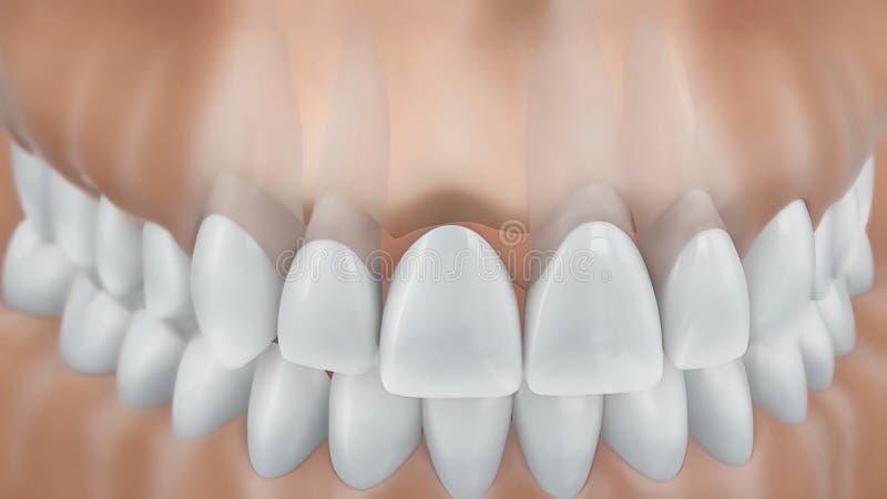 Pressure from the Lower Teeth To the Upper Teeth Stock Illustration ...