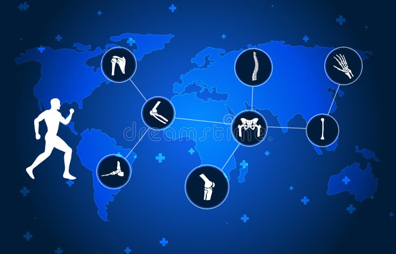 Medical Infographic Orthopedic Anatomy. Stock Vector - Illustration of ...