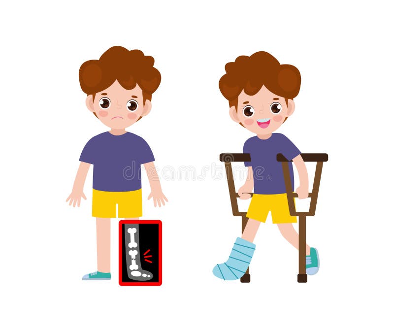 Cartoon Leg Cast Stock Illustrations – 792 Cartoon Leg Cast Stock ...