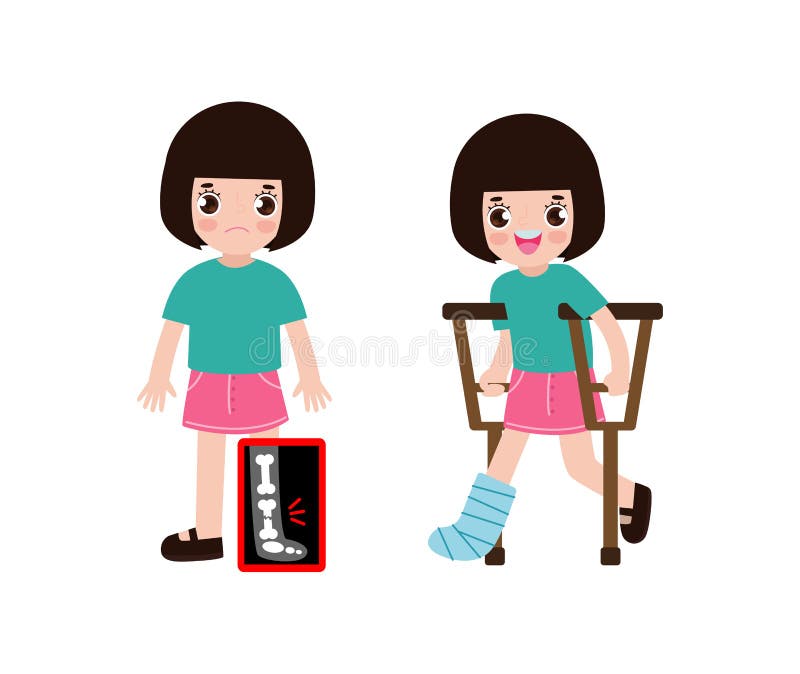 Cute Cartoon Asian Children with Broken Leg on X-ray and Recovering ...