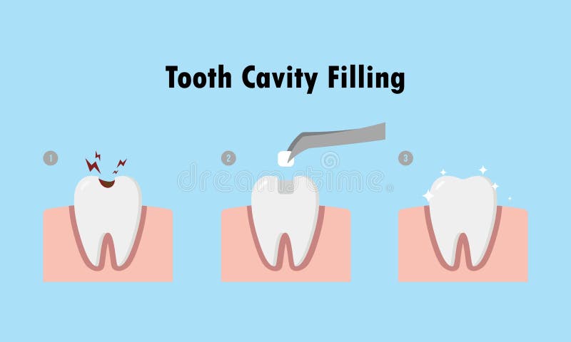 Tooth Filling Character Stock Illustrations – 294 Tooth Filling ...