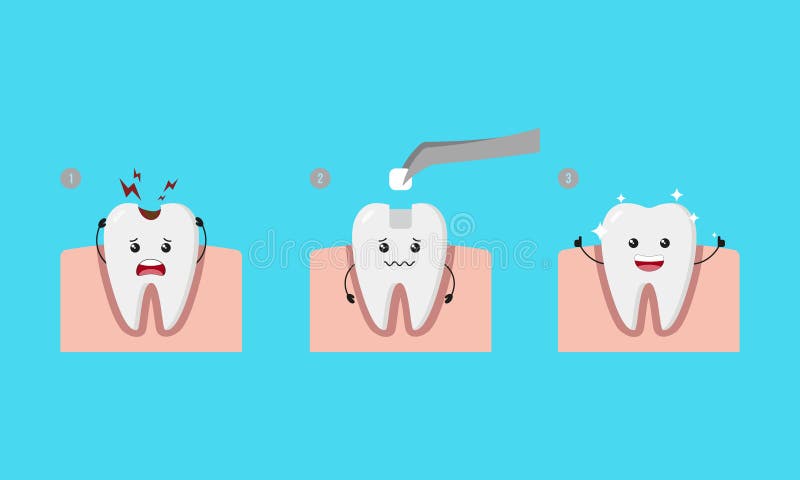 Cartoon Dentist Filling Tooth Stock Illustrations – 351 Cartoon Dentist ...