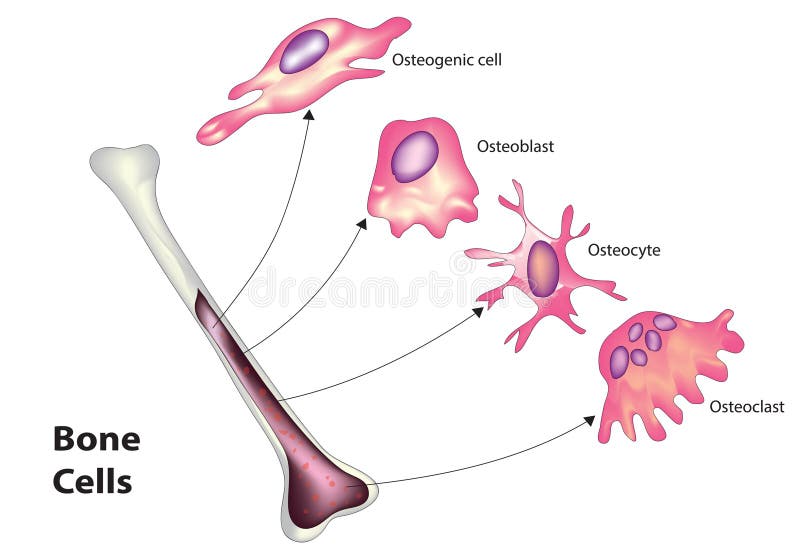 Bone cell classification stock vector. Illustration of cancer - 320651338