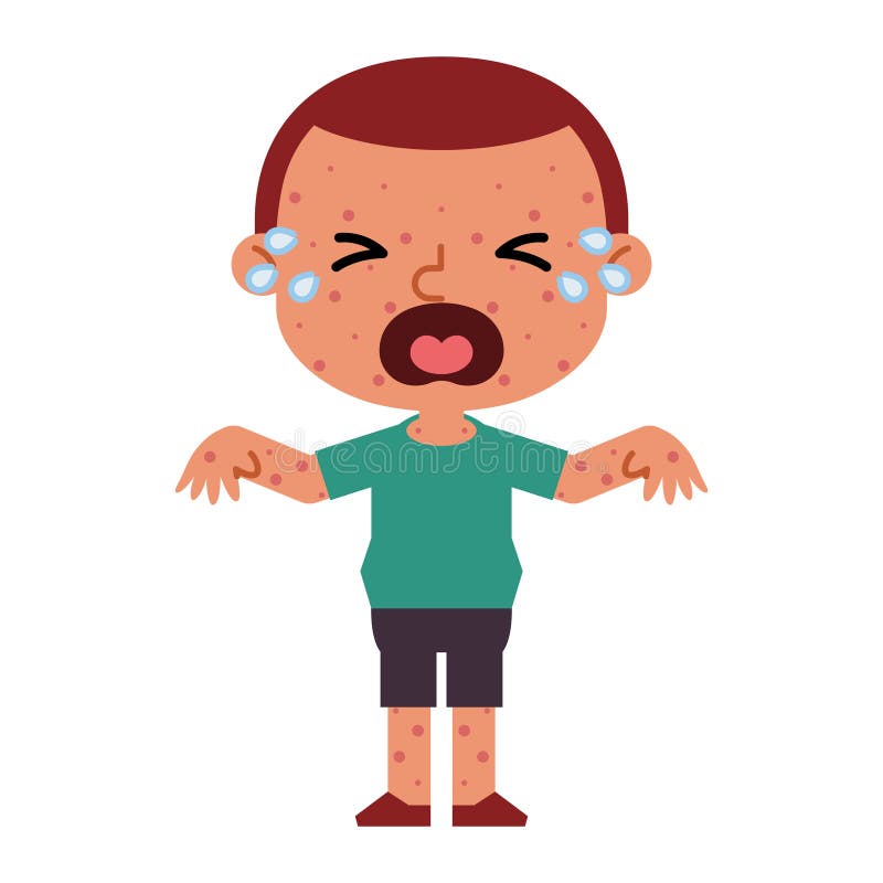 Sad Kid Boy Having Chicken Pox. Red Spots Appearing on the Skin. Viral ...