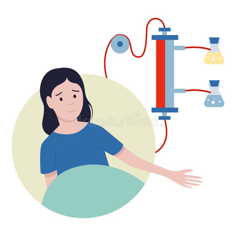 Hemodialysis. Scheme of Artificial Blood Purification Stock ...