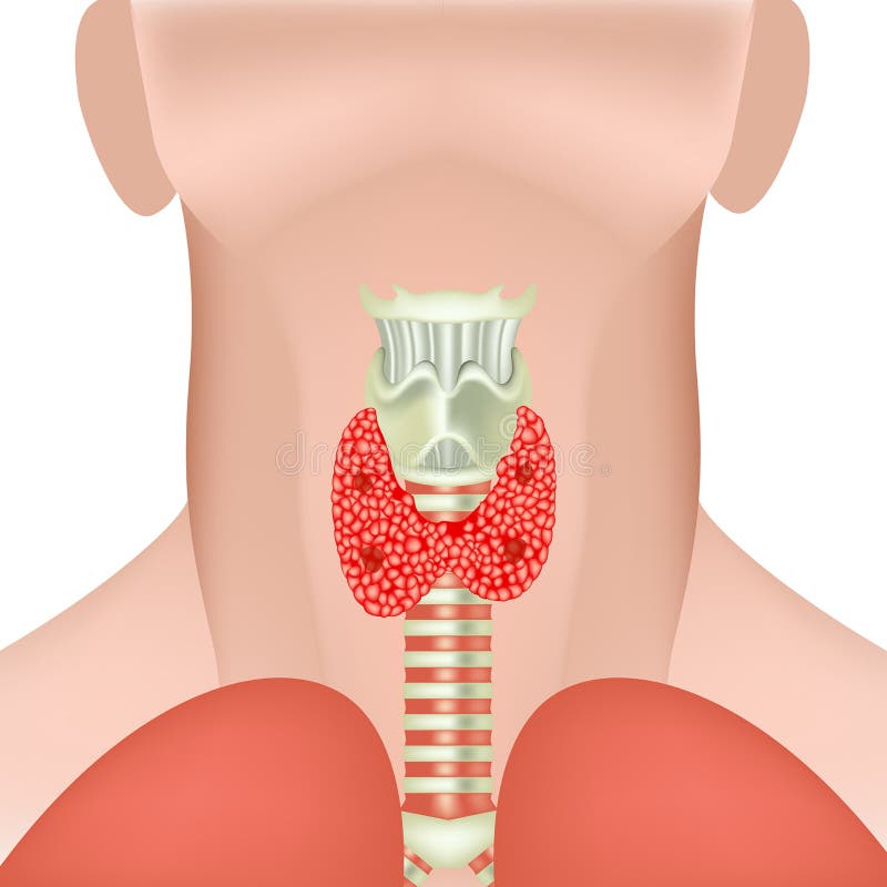 Thyroid Gland. Diagram with Neck and Trachea Stock Vector ...
