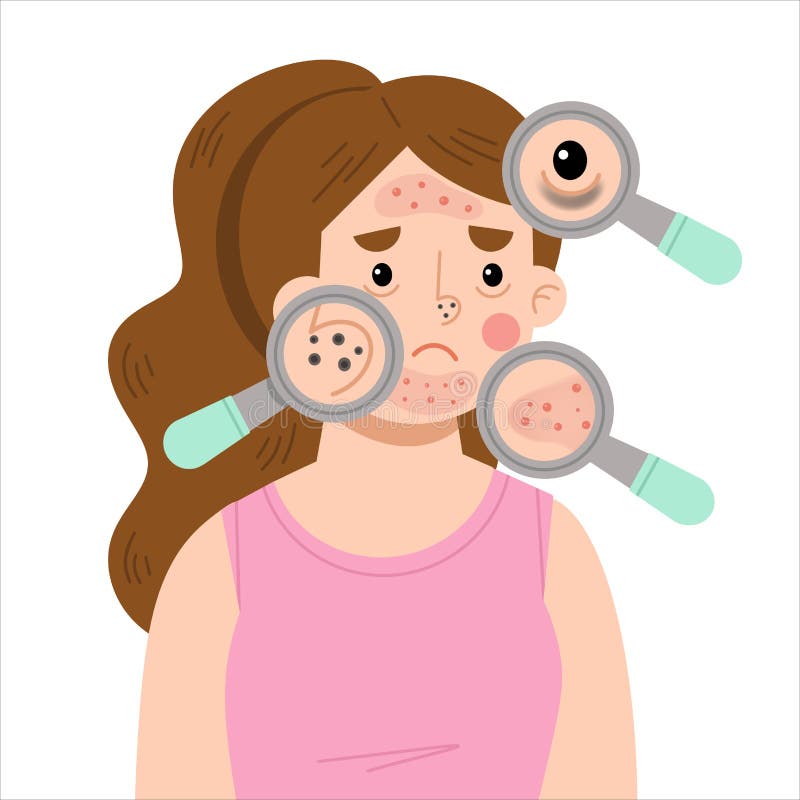 Illustration of a Woman with Skin Problems Stock Vector - Illustration ...