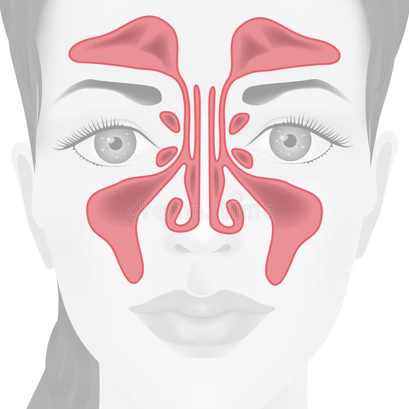 Medical Poster with Girl S Face and Maxillary Sinuses Designation ...