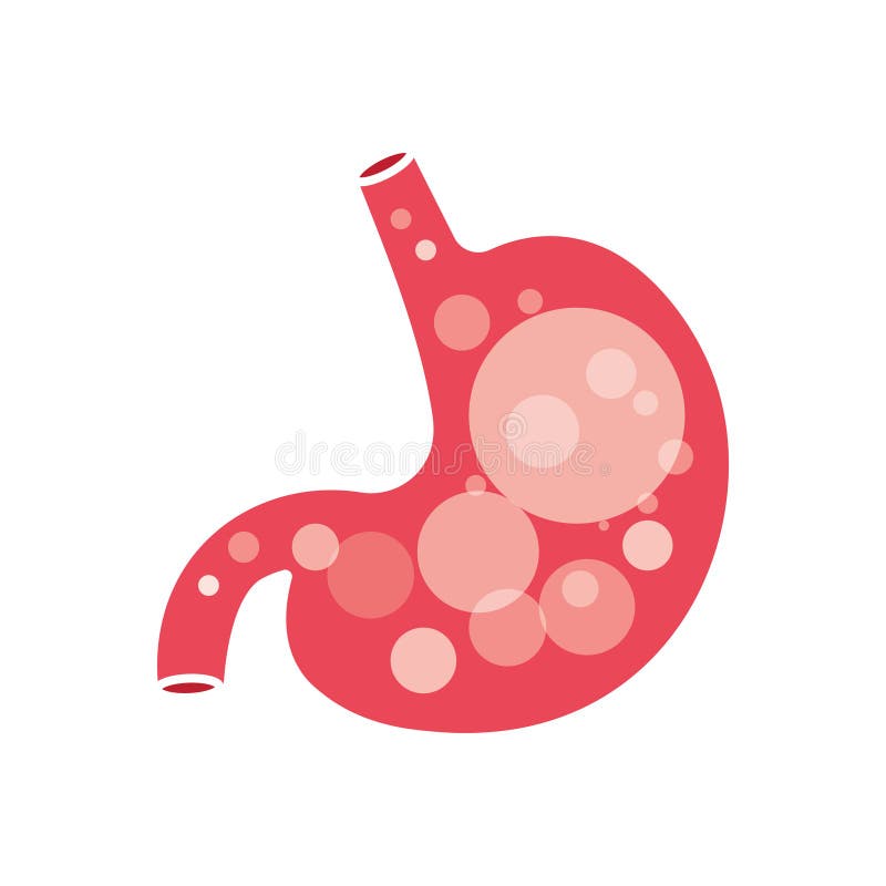 Isolated Illustration of Gastric Gas, Showing the Stomach Filled with ...