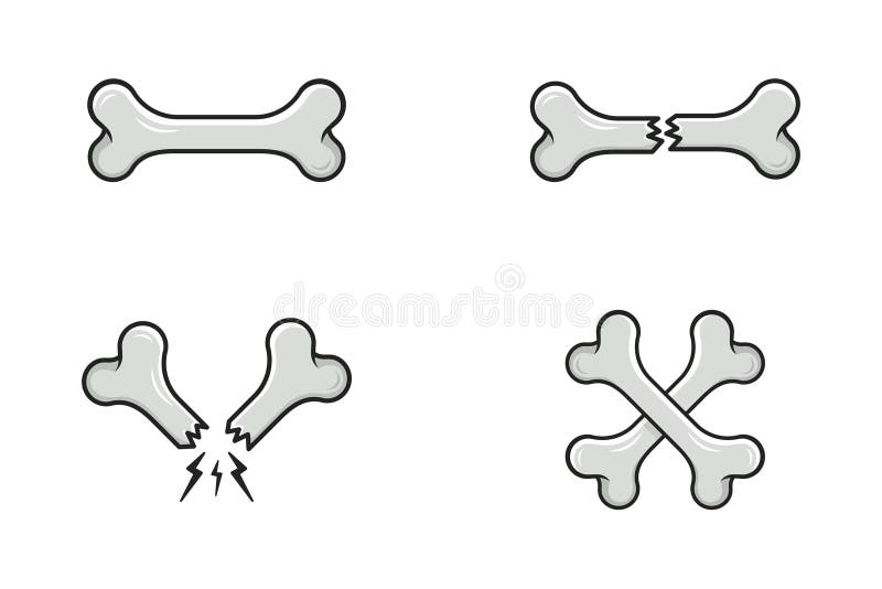 Cartoon Bone Icons – Whole, Broken, Crossed Bones Set Stock Vector ...
