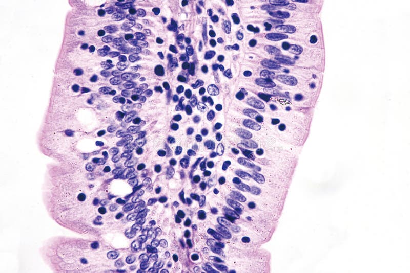 Human Small intestine stock photo. Image of ileum, anatomy - 377988166