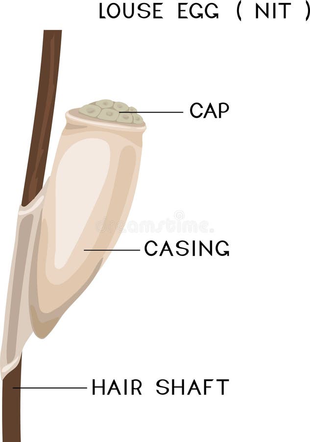 Structure of Head Louse Egg (nit) Attached To a Hair Stock Vector ...
