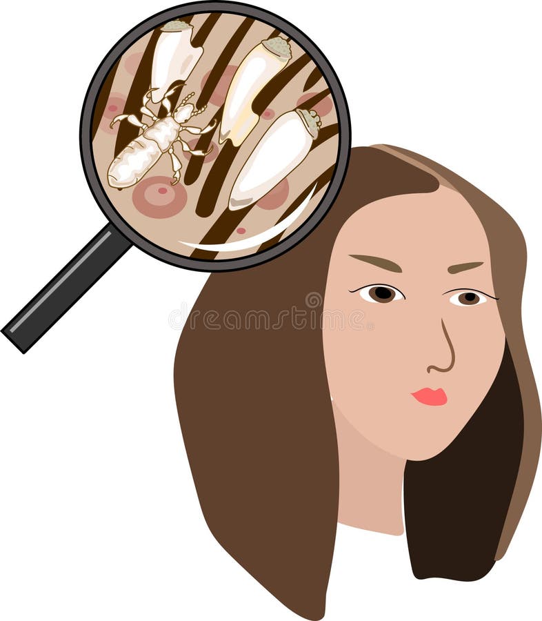 Lice Check. Head of Woman and Head Louse Nymph with Eggs (nits ...