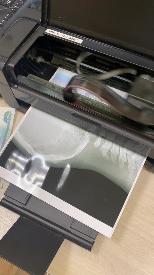 Printer stock video. Video of medicine, teleroentgenogram - 250601163