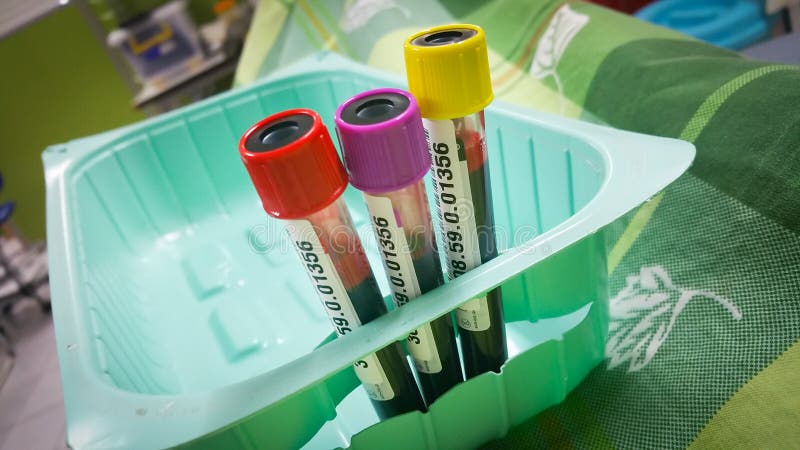 Prises de sang image stock. Image du sang, liquide, tube - 23414809