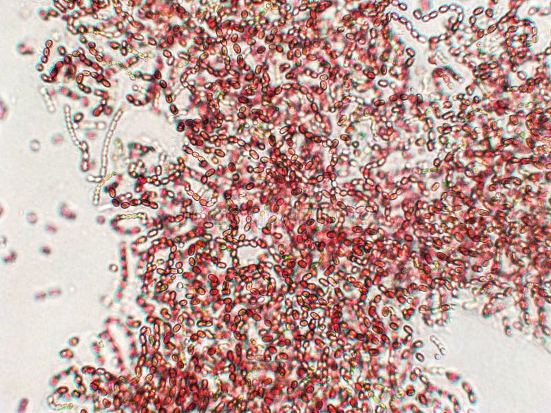 Probiotics, Lactic Acid Bacteria. Algae, Bacteria and Microorganisms ...