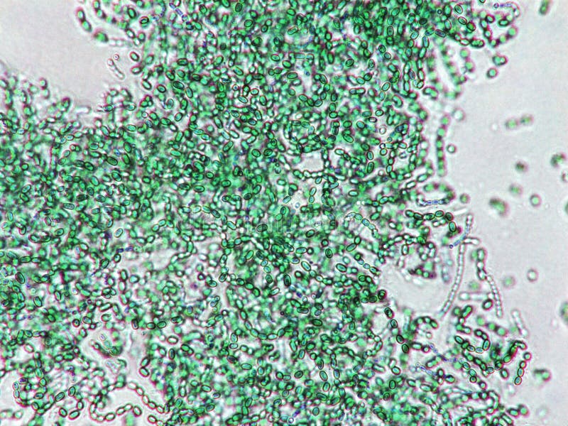 Probiotics, Lactic Acid Bacteria. Algae, Bacteria and Microorganisms ...