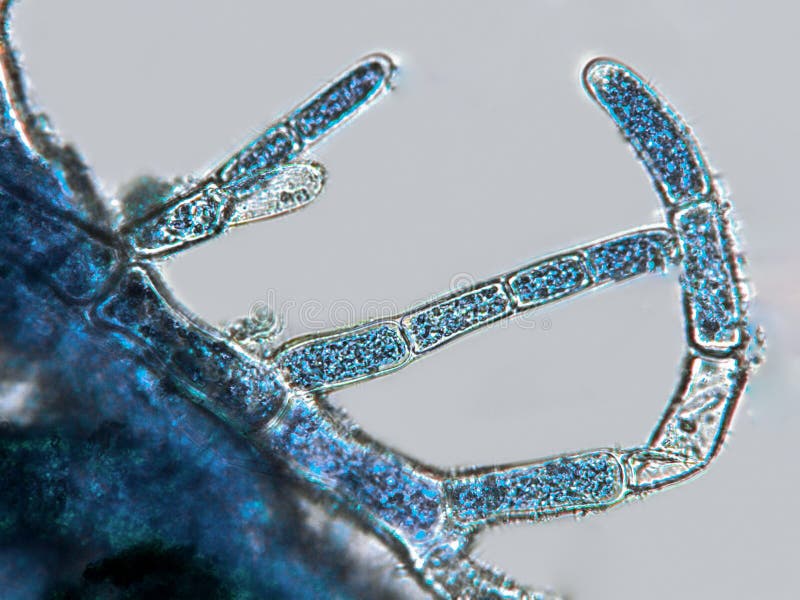 Probiotics, Lactic Acid Bacteria. Algae, Bacteria and Microorganisms ...