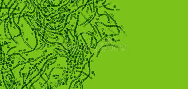 Probiotics, Lactic Acid Bacteria. Algae, Bacteria and Microorganisms ...