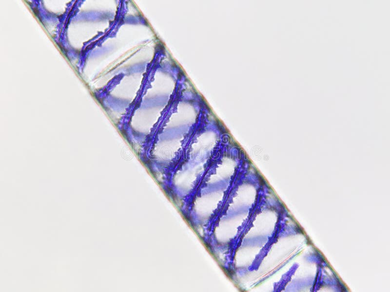 Probiotics, Lactic Acid Bacteria. Algae, Bacteria and Microorganisms ...