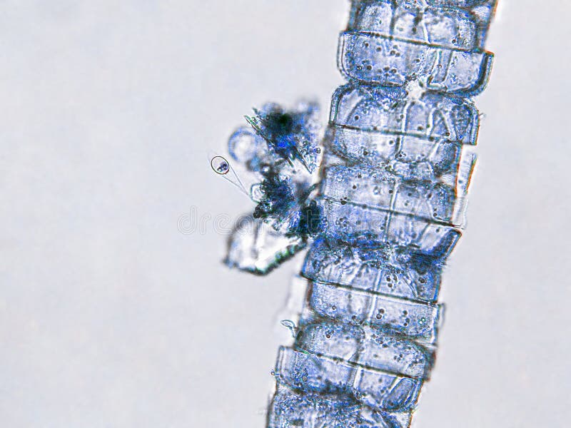 Probiotics, Lactic Acid Bacteria. Algae, Bacteria and Microorganisms ...