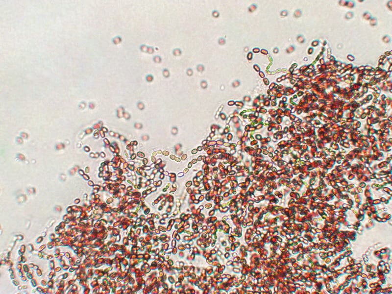 Probiotics, Lactic Acid Bacteria. Algae, Bacteria and Microorganisms ...