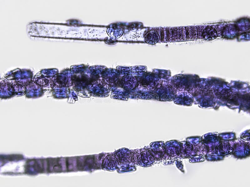 Probiotics, Lactic Acid Bacteria. Algae, Bacteria and Microorganisms ...