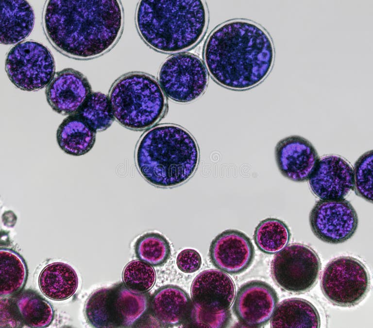 Probiotics, Lactic Acid Bacteria. Algae, Bacteria and Microorganisms ...